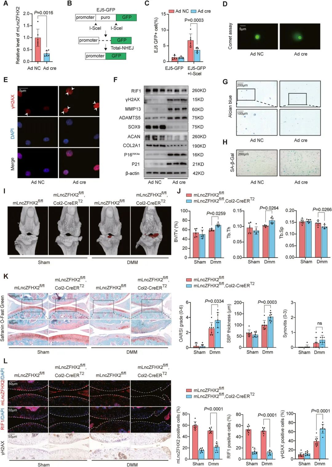 Redox Biology（IF11.4）丨LncZFHX2促进DNA修复以介导骨关节炎病理学医药新闻-ByDrug-一站式医药资源共享中心-医药魔方