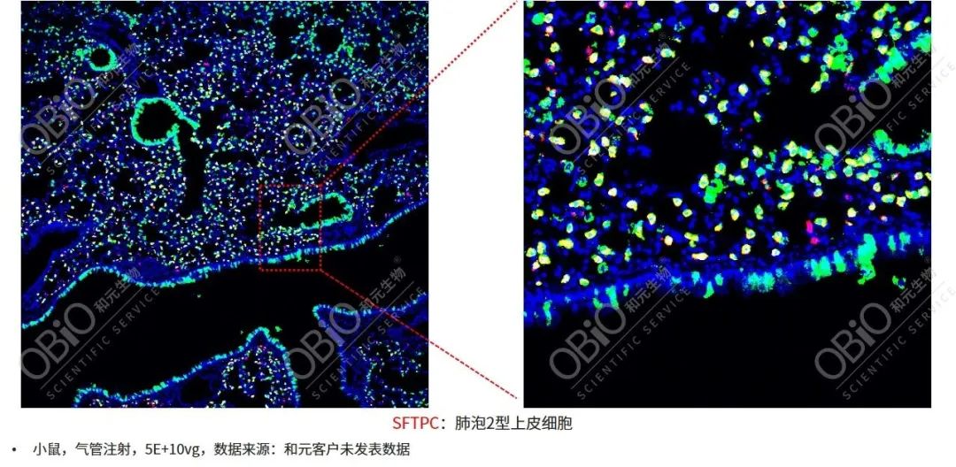 新品发布 | 肺靶向全新AAV载体来袭，三大优势破解精准基因递送难题医药新闻-ByDrug-一站式医药资源共享中心-医药魔方