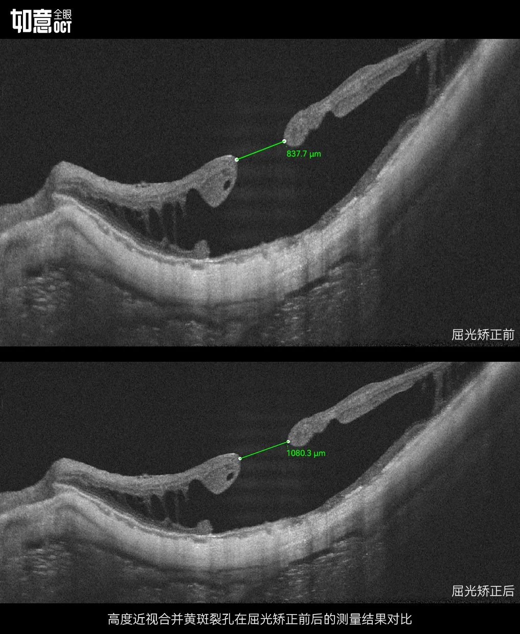 如意全眼OCT：眼底病一站式解决方案医药新闻-ByDrug-一站式医药资源共享中心-医药魔方