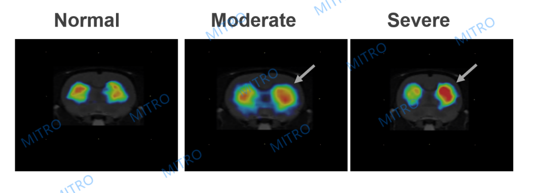 放射性同位素标记及PET技术在帕金森疾病研究中的应用（一）医药新闻-ByDrug-一站式医药资源共享中心-医药魔方