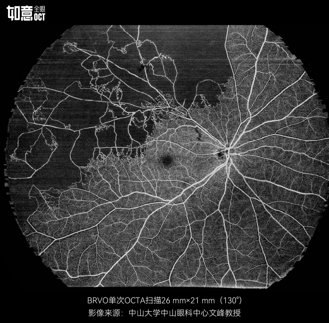 如意全眼OCT：眼底病一站式解决方案医药新闻-ByDrug-一站式医药资源共享中心-医药魔方
