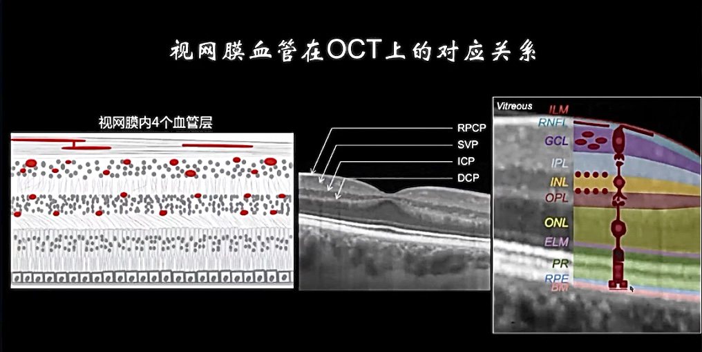 OCTA报告解读 | 教你层层分析识病变医药新闻-ByDrug-一站式医药资源共享中心-医药魔方