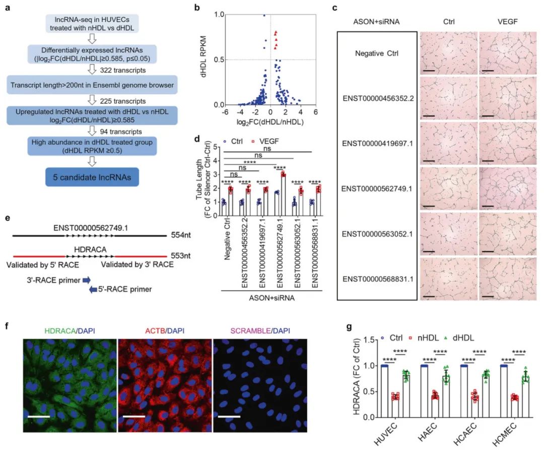 Nature子刊（IF39.3）丨锐博PolyA-seq助力发现HDL通过lncRNA HDRACA调控血管生成的分子机制医药新闻-ByDrug-一站式医药资源共享中心-医药魔方
