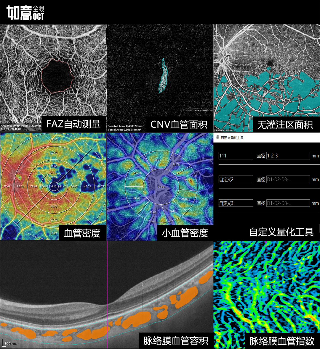 如意全眼OCT：眼底病一站式解决方案医药新闻-ByDrug-一站式医药资源共享中心-医药魔方