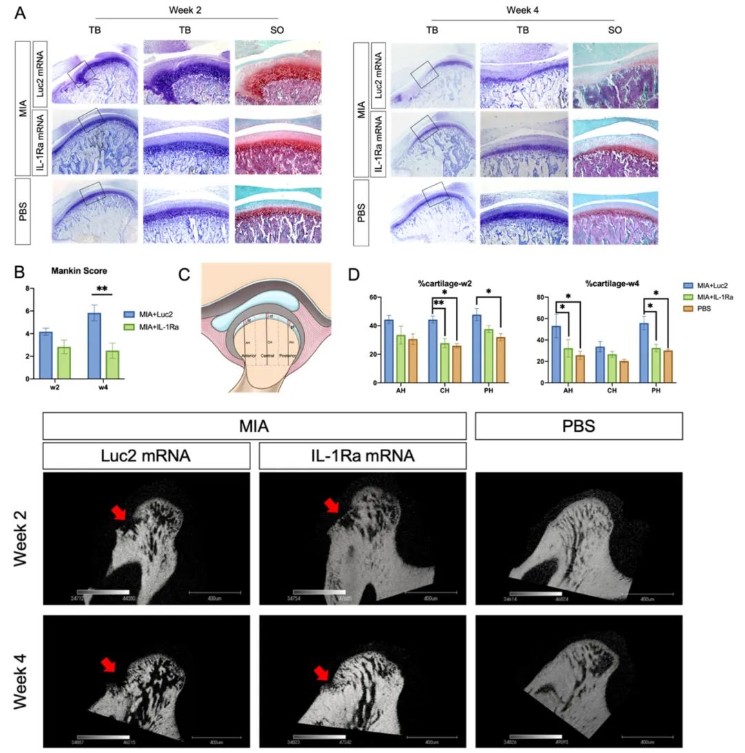 Pharmaceutics丨编码IL-1Ra的mRNA药物对颞下颌关节骨关节炎的抗炎治疗医药新闻-ByDrug-一站式医药资源共享中心-医药魔方