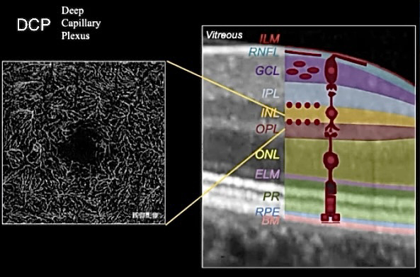 OCTA报告解读 | 教你层层分析识病变医药新闻-ByDrug-一站式医药资源共享中心-医药魔方