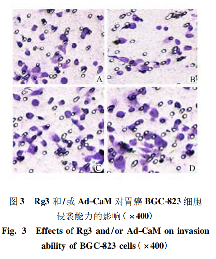 人参皂苷Rg3通过Ca2+/CaM信号系统抑制胃癌BGC-823细胞增殖及其可能的机制医药新闻-ByDrug-一站式医药资源共享中心-医药魔方