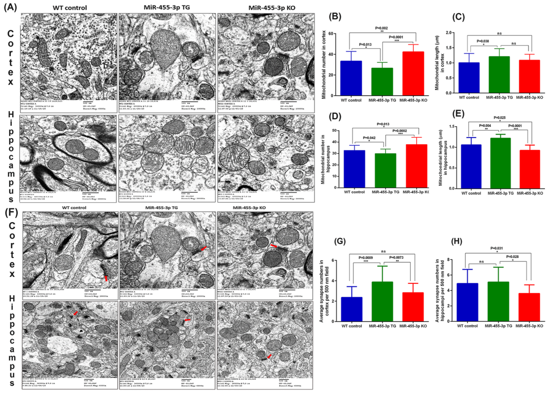 miRNA最新研究进展盘点（20211119）医药新闻-ByDrug-一站式医药资源共享中心-医药魔方