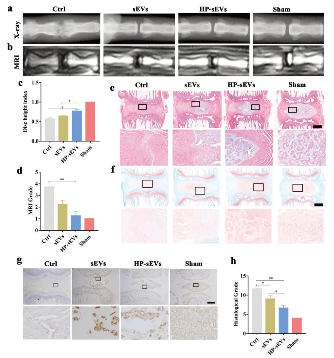 Adv Sci丨HP-sEVs通过激活Mir-7-5p/NF-Κb/Cxcl2轴促进椎间盘再生医药新闻-ByDrug-一站式医药资源共享中心-医药魔方