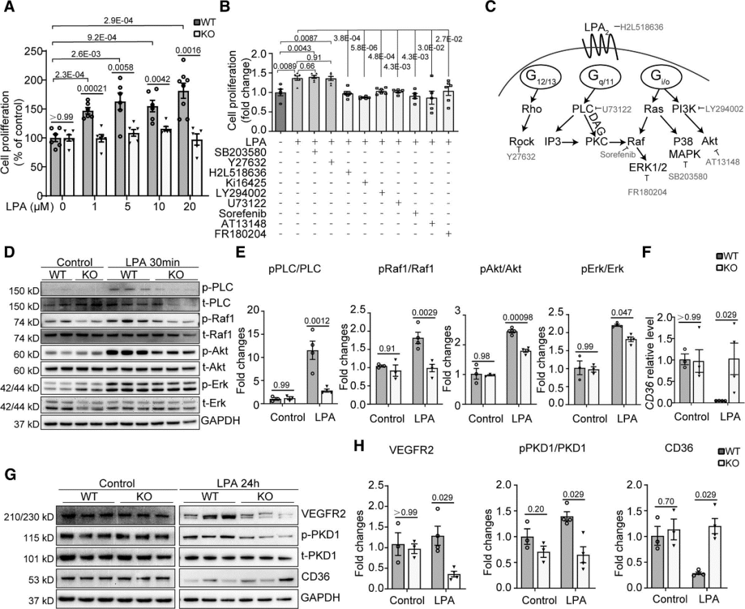 《CIRCULATIONRESEARCH》丨LPA2有望成为心脏治疗的靶点医药新闻-ByDrug-一站式医药资源共享中心-医药魔方