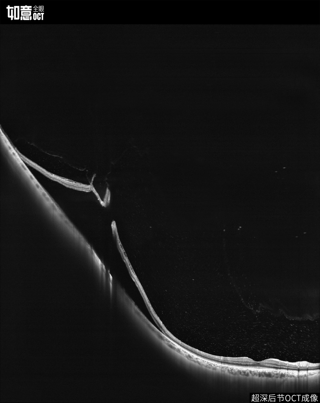 全眼轴可视化生物测量与OCT完美融合，视微如意全眼OCT新技术发布医药新闻-ByDrug-一站式医药资源共享中心-医药魔方