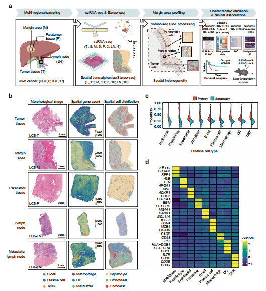 利用Stereo-seq空间转录组识别肝癌侵袭区域医药新闻-ByDrug-一站式医药资源共享中心-医药魔方