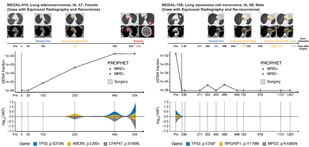 【Cancer Cell，IF 50.3】MEDAL：全球首个早期肺癌头对头对比MRD检测策略的前瞻性临床研究结果正式发表医药新闻 ...