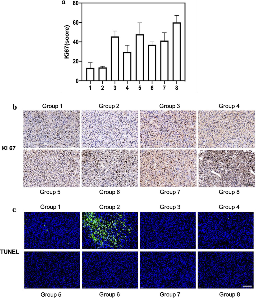 胶质细胞瘤中治疗性核通道BNCT药物联合靶向CD47的基因编辑医药新闻-ByDrug-一站式医药资源共享中心-医药魔方