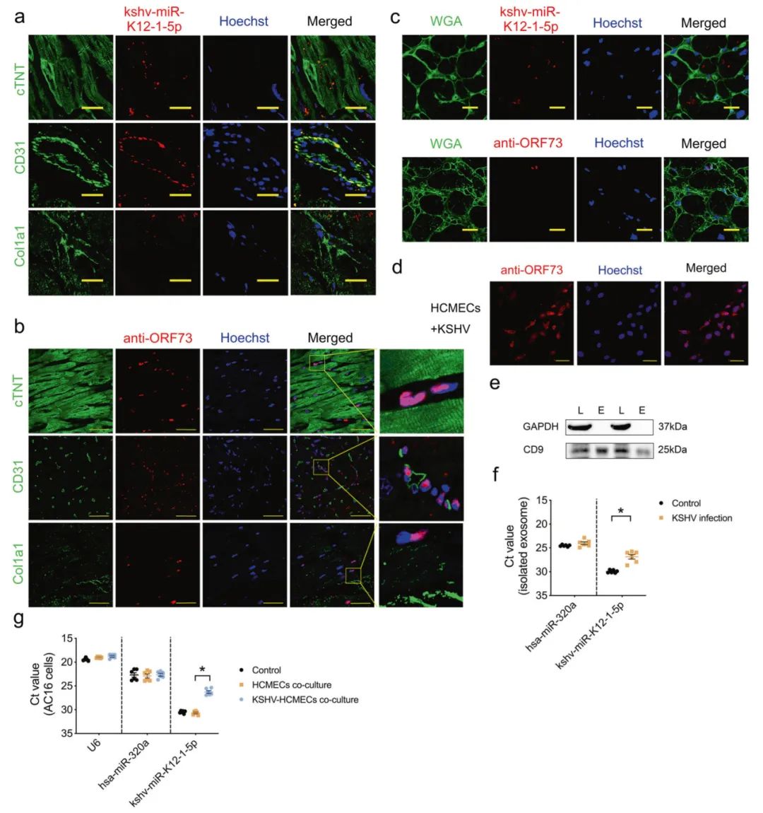 Nature子刊（IF39.3）丨卡波西肉瘤相关疱疹病毒编码的microRNA导致扩张型心肌病医药新闻-ByDrug-一站式医药资源共享中心-医药魔方