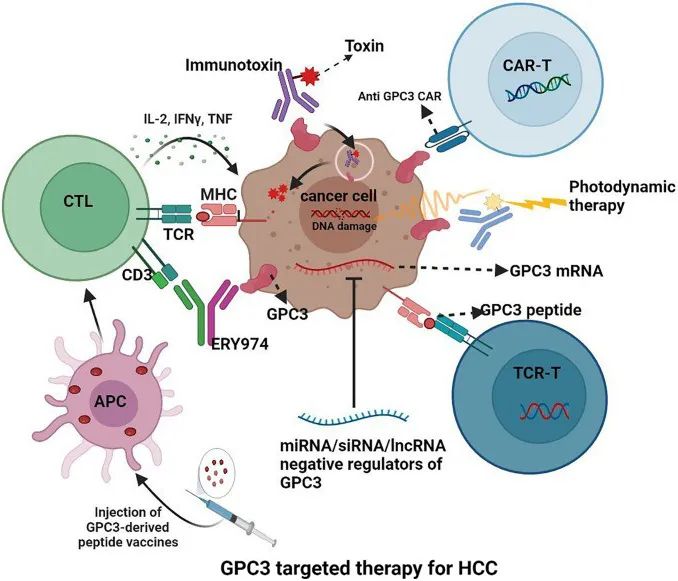 GPC3 CAR-T细胞联合索拉非尼，肿瘤病灶完全消失医药新闻-ByDrug-一站式医药资源共享中心-医药魔方