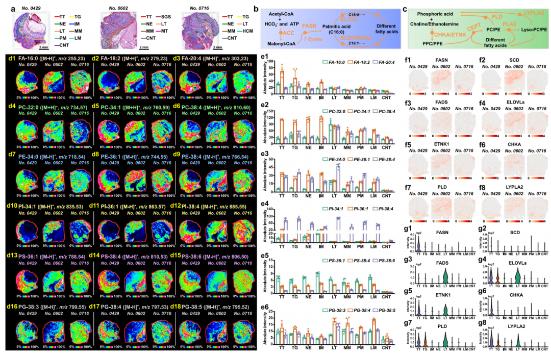 NC（IF17）|空间多组学揭示胃癌细胞特异性的代谢重塑和相互作用医药新闻-ByDrug-一站式医药资源共享中心-医药魔方