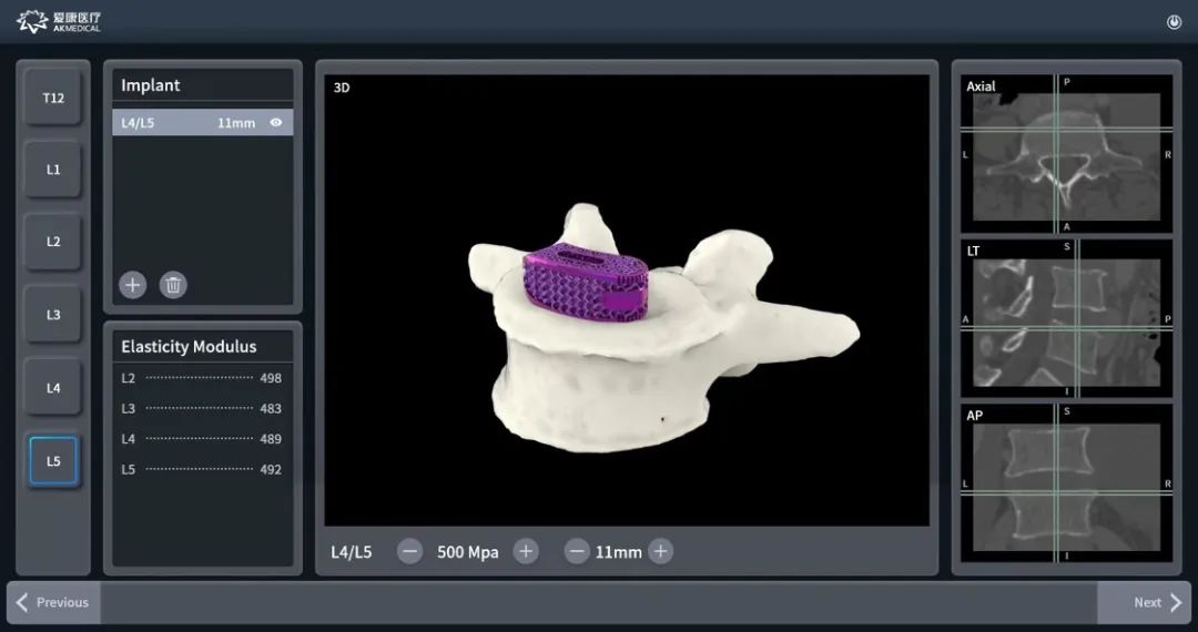 5年研发，首次应用！骨科3D打印取得新突破医药新闻-ByDrug-一站式医药资源共享中心-医药魔方