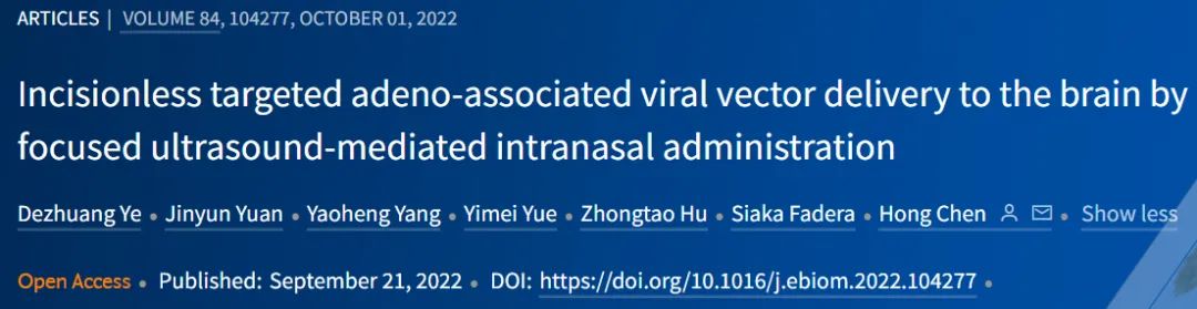 新型AAV脑内递送技术来了：效率提高2000多倍，或带来基因治疗新突破医药新闻-ByDrug-一站式医药资源共享中心-医药魔方