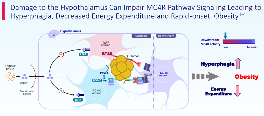 罕见遗传性肥胖疗法setmelanotide在国内首次获批临床医药新闻-ByDrug-一站式医药资源共享中心-医药魔方