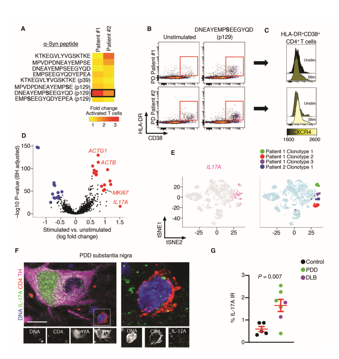 CD4+T细胞参与路易体痴呆的神经退行性变医药新闻-ByDrug-一站式医药资源共享中心-医药魔方