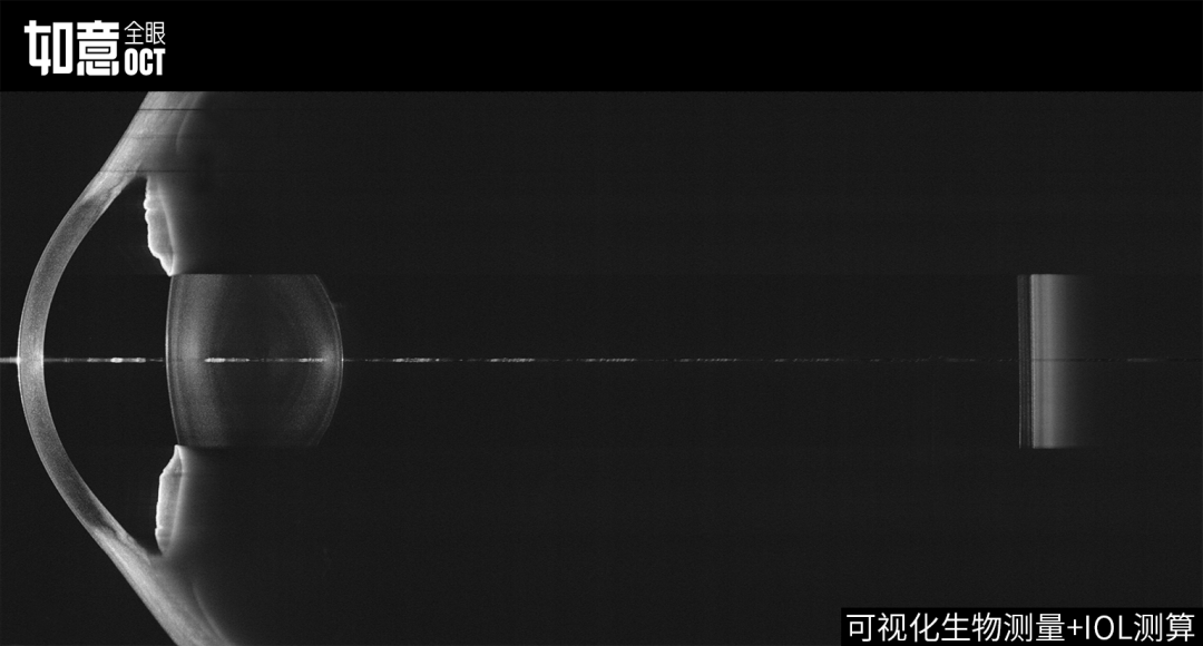 全眼轴可视化生物测量与OCT完美融合，视微如意全眼OCT新技术发布医药新闻-ByDrug-一站式医药资源共享中心-医药魔方