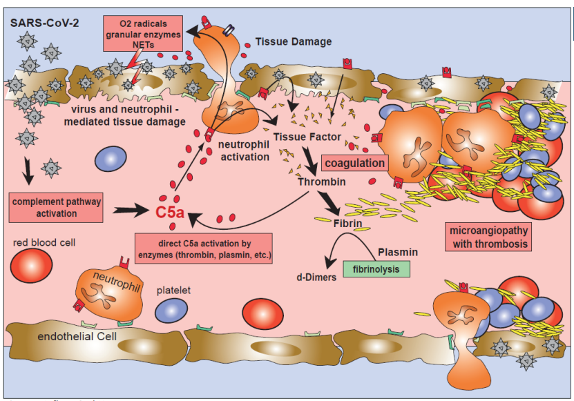 IFRX官宣：全球韦洛利单抗临床进展情况医药新闻-ByDrug-一站式医药资源共享中心-医药魔方