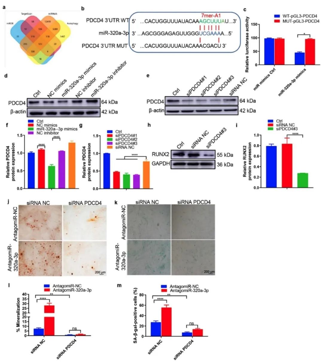 吉凯助力！中南大学研究团队通过miRNA测序揭示外泌体-miRNA在冷暴露小鼠动脉钙化发展中的功能和作用医药新闻-ByDrug-一站式医药资源 ...