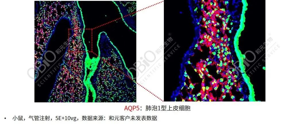 新品发布 | 肺靶向全新AAV载体来袭，三大优势破解精准基因递送难题医药新闻-ByDrug-一站式医药资源共享中心-医药魔方