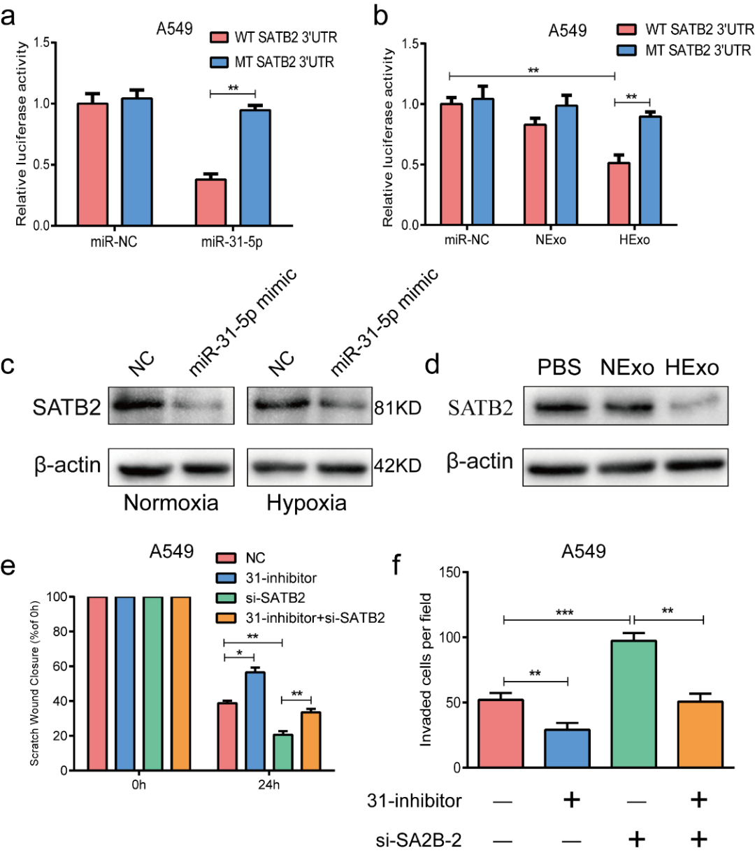 学术成果|缺氧肿瘤来源的外泌体miR-31-5p通过负调节SATB2逆转EMT和激活MEK/ERK信号促进肺腺癌转移医药新闻-ByDrug-一站式医药资源共享中心-医药魔方