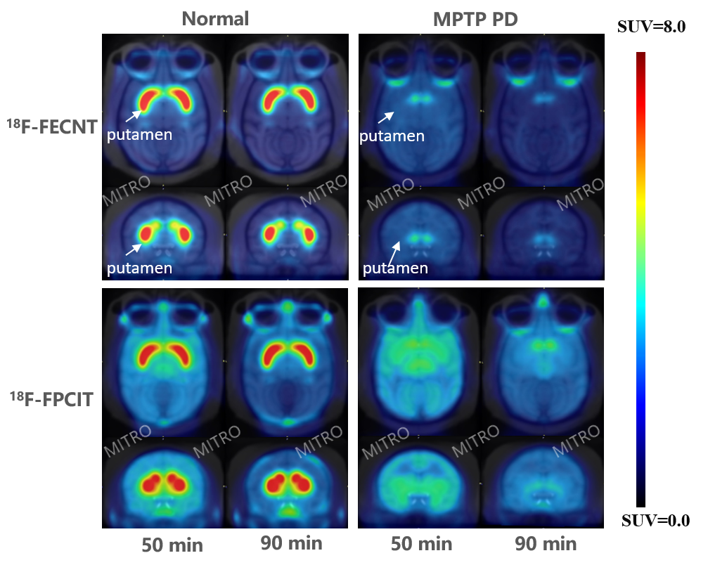 放射性同位素标记及PET技术在帕金森疾病研究中的应用（二）医药新闻-ByDrug-一站式医药资源共享中心-医药魔方