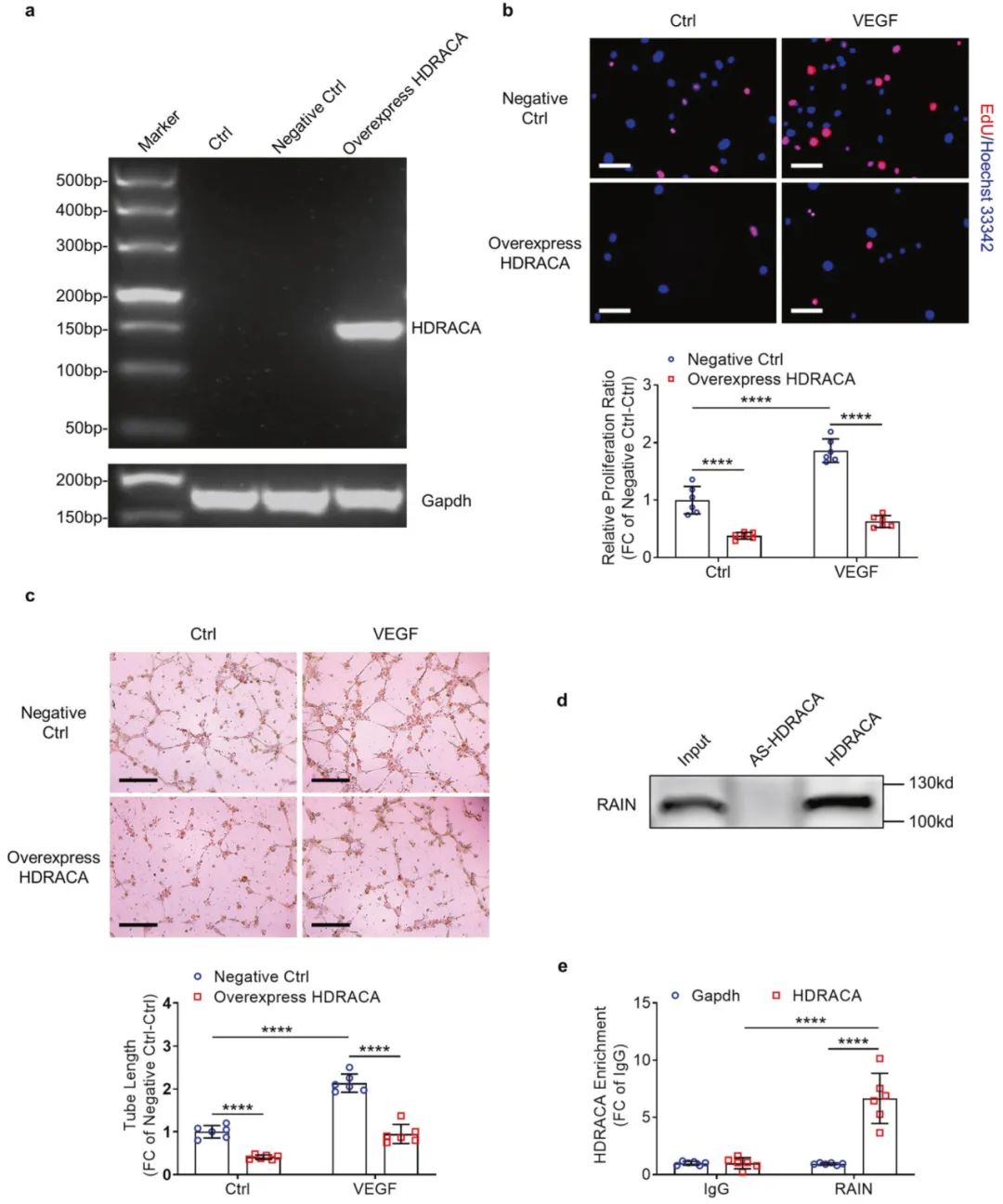 Nature子刊（IF39.3）丨锐博PolyA-seq助力发现HDL通过lncRNA HDRACA调控血管生成的分子机制医药新闻-ByDrug-一站式医药资源共享中心-医药魔方