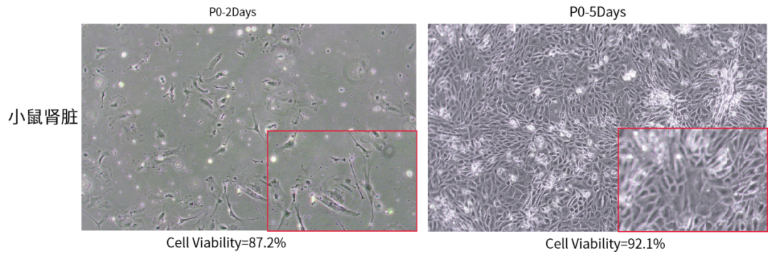 Singleron PythoN™焕然升级|解离管DNFU为细胞培养全新设计医药新闻-ByDrug-一站式医药资源共享中心-医药魔方