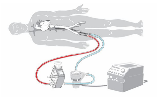 SimECMO-海归科学家打造新一代国产ECMO训练模拟系统医药新闻-ByDrug-一站式医药资源共享中心-医药魔方