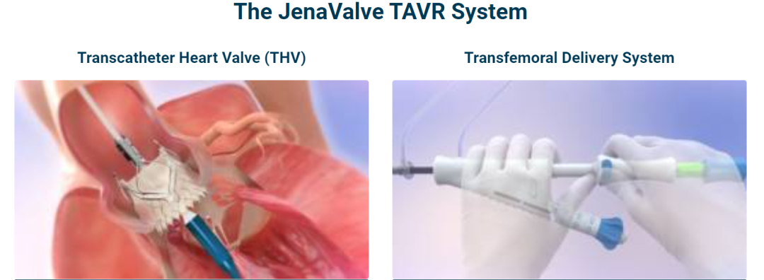 JenaValve完成1亿美元C轮融资，贝恩资本领投医药新闻-ByDrug-一站式医药资源共享中心-医药魔方