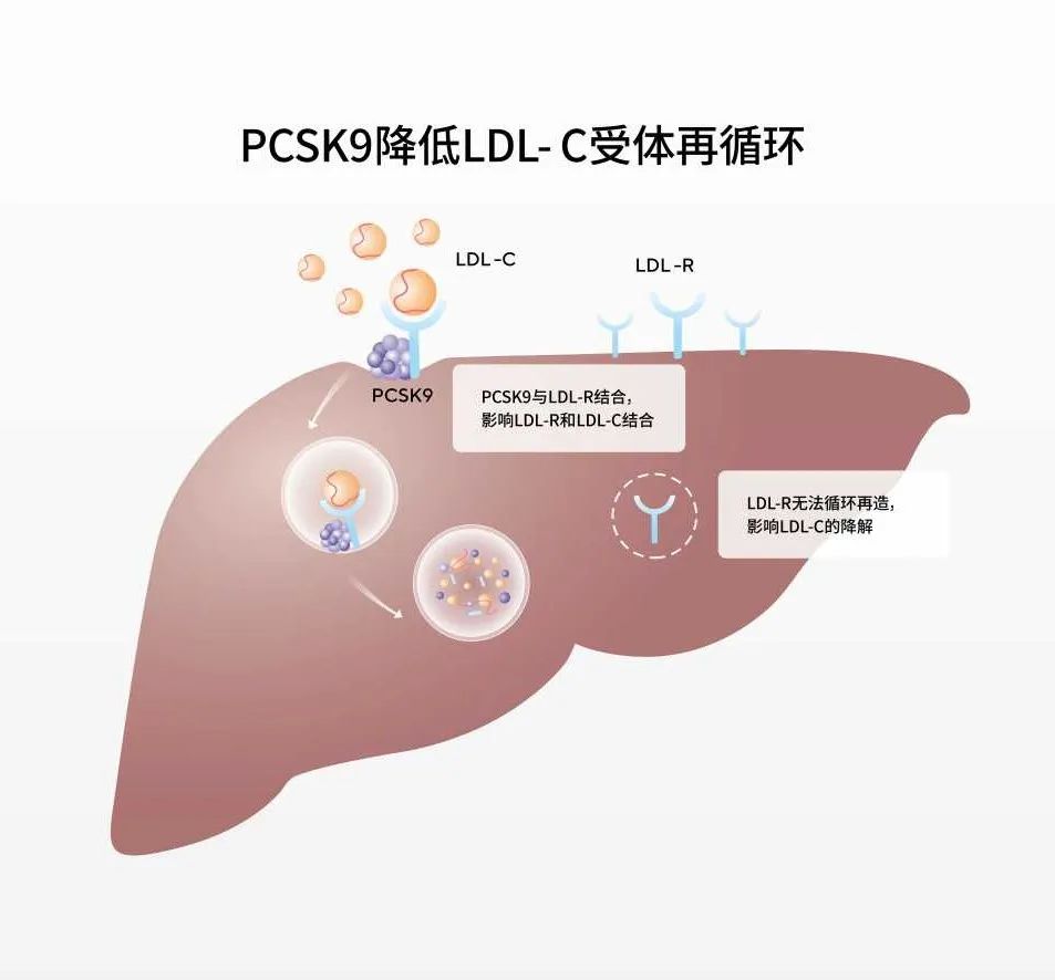 中国首个自主研发的PCSK9抑制剂信必乐®获批上市，用于治疗原发性高胆固醇血症和混合型血脂异常患者医药新闻-ByDrug-一站式医药资源共享中心-医药魔方