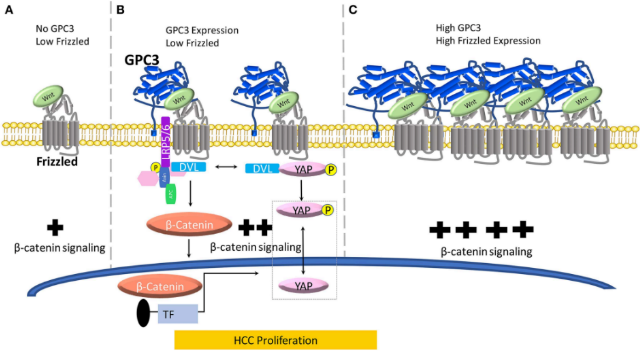 GPC3 CAR-T细胞联合索拉非尼，肿瘤病灶完全消失医药新闻-ByDrug-一站式医药资源共享中心-医药魔方